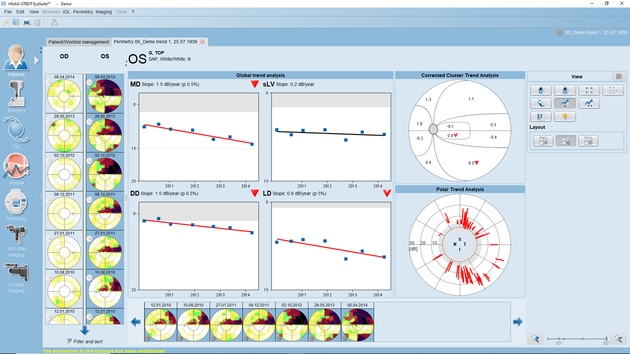 Octopus 600 - EyeSuite glaucoma analysis